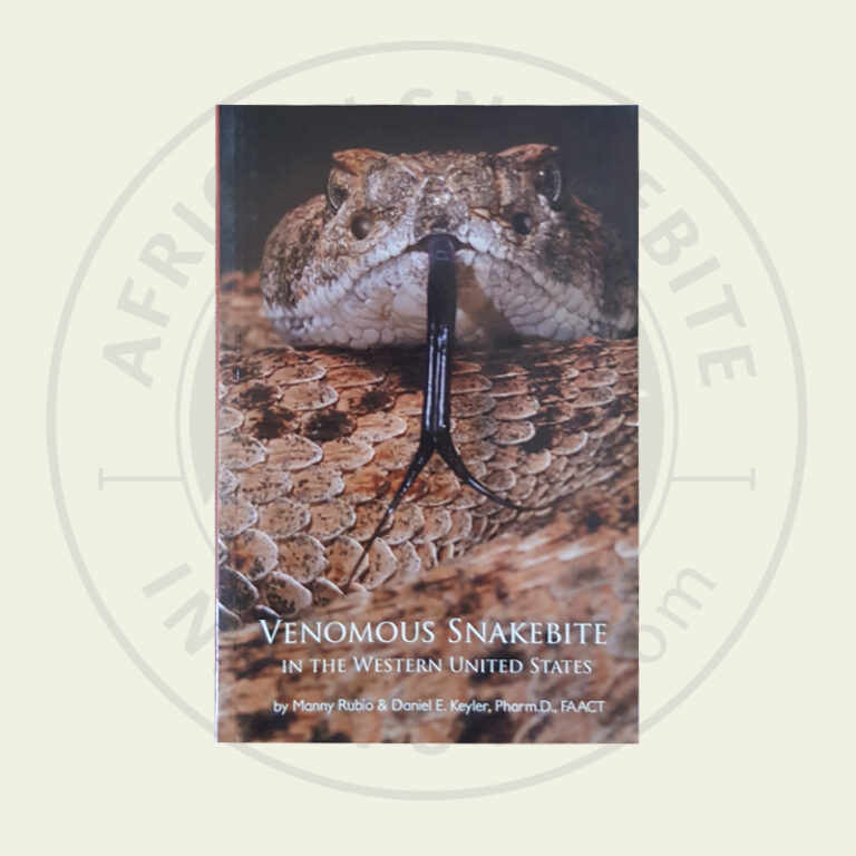 Venomous Snakebite in the Western United States - African Snakebite ...